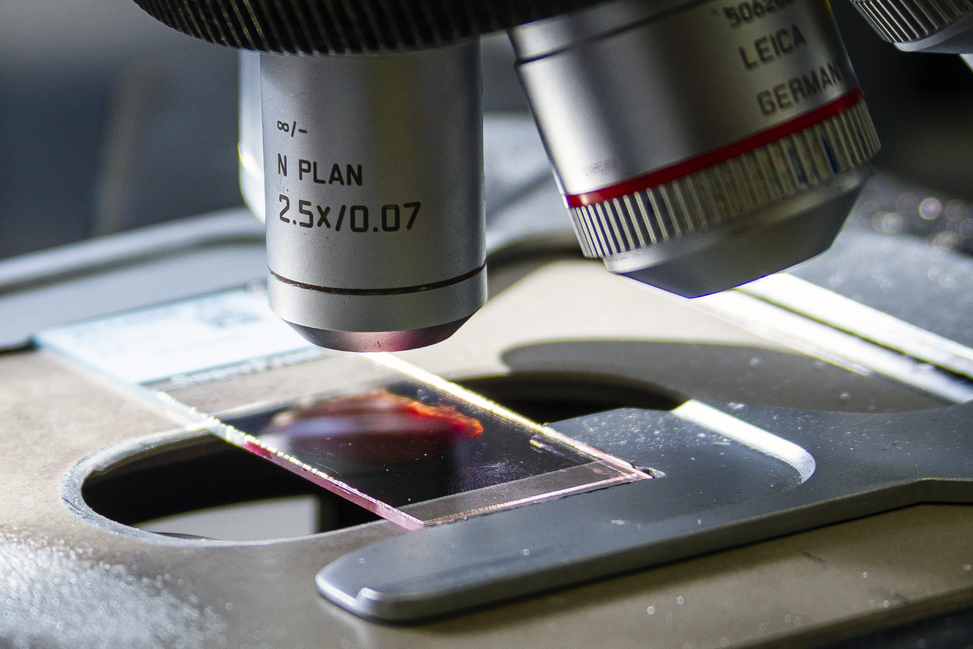 Anatomo cyto pathologie - Hôpitaux La Rochelle Ré Aunis