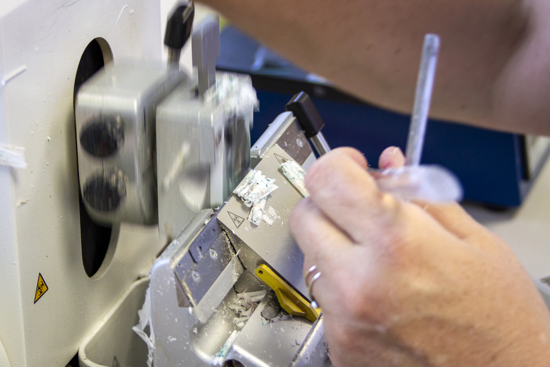 Anatomo cyto pathologie - Hôpitaux La Rochelle Ré Aunis